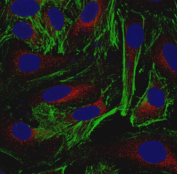 Anti-Actin Antibody, clone 2G2 | MABT826